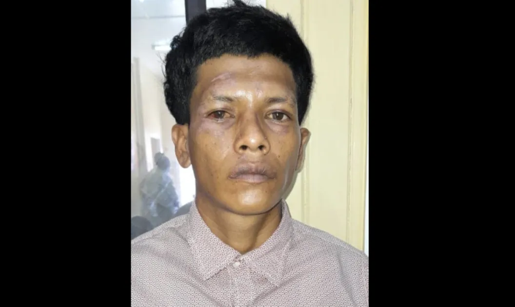 Man who was brutally beaten sentenced to 1 year in Guyana, while ...