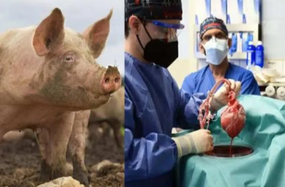 Man receives a pig's heart in the world's first animal to human heart ...
